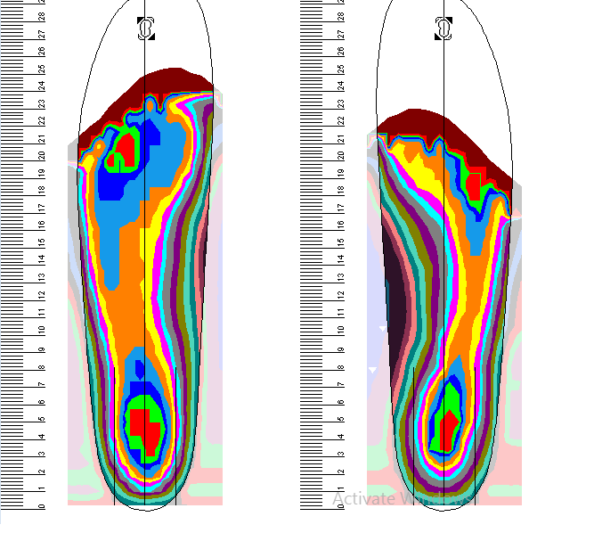Πεδορθωτική - Φυσικοθεραπευτήριο Σπύρος Γιγουρτάκης