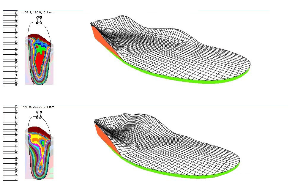 Πεδορθωτική - Φυσικοθεραπευτήριο Σπύρος Γιγουρτάκης