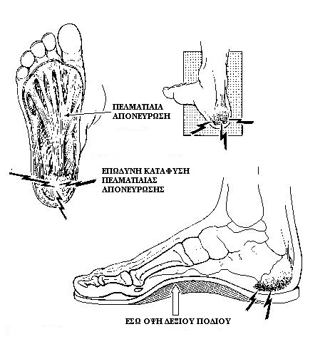 Βασικά ανατομικά στοιχεία και παθήσεις Άκρου Ποδός - Φυσικοθεραπευτήριο ...