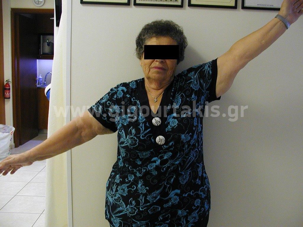 ΚΑΤΑΓΜΑ ΒΡΑΧΙΟΝΙΟΥ - Φυσικοθεραπευτήριο Σπύρος Γιγουρτάκης