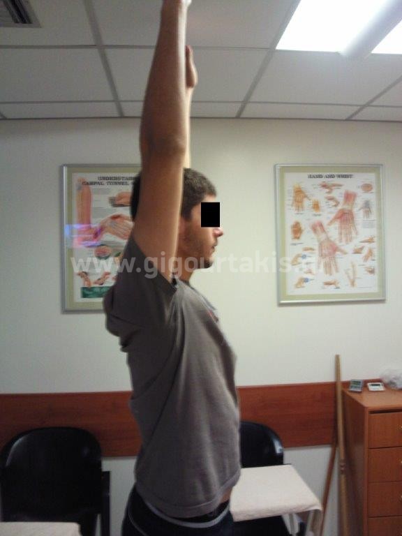 ΡΗΞΗ ΠΕΤΑΛΟΥ ΣΤΡΟΦΕΩΝ (ROTATOR CUFF) - Φυσικοθεραπευτήριο Σπύρος ...