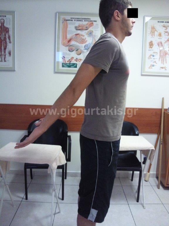 ΡΗΞΗ ΠΕΤΑΛΟΥ ΣΤΡΟΦΕΩΝ (ROTATOR CUFF) - Φυσικοθεραπευτήριο Σπύρος ...