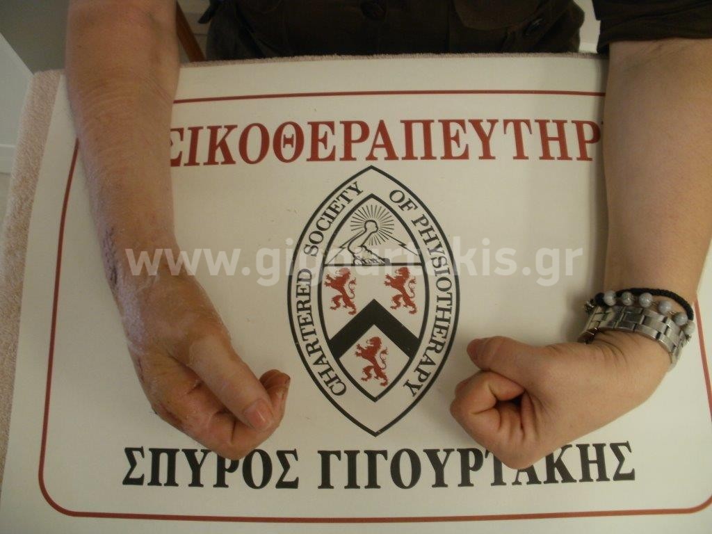 ΟΣΤΕΟΝΕΚΡΩΣΗ - Φυσικοθεραπευτήριο Σπύρος Γιγουρτάκης