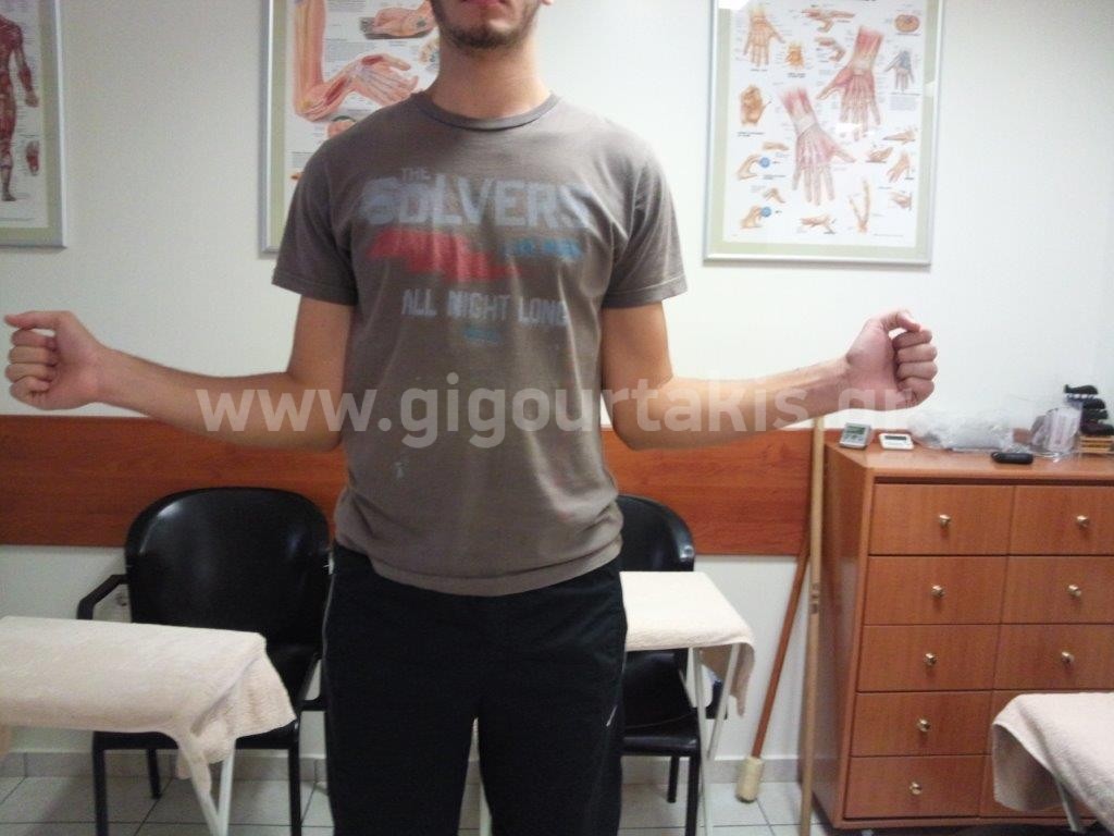 ΡΗΞΗ ΠΕΤΑΛΟΥ ΣΤΡΟΦΕΩΝ (ROTATOR CUFF) - Φυσικοθεραπευτήριο Σπύρος ...