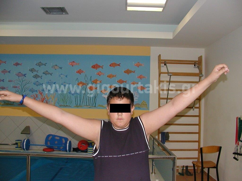 ΚΑΤΑΓΜΑ ΒΡΑΧΙΟΝΙΟΥ-ΚΑΤΑΓΜΑ ΥΠΟΚΕΦΑΛΙΚΟ-ΠΑΙΔΙΚΟ - Φυσικοθεραπευτήριο ...