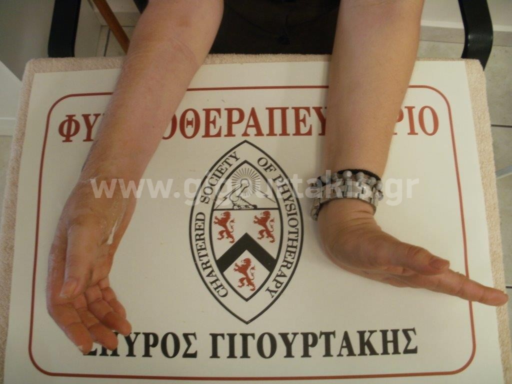 ΟΣΤΕΟΝΕΚΡΩΣΗ - Φυσικοθεραπευτήριο Σπύρος Γιγουρτάκης