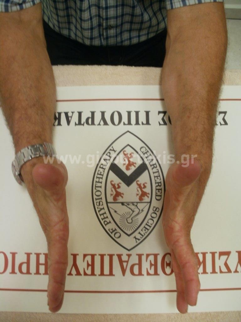 ΜΕΙΚΤΕΣ ΚΑΚΩΣΕΙΣ - Φυσικοθεραπευτήριο Σπύρος Γιγουρτάκης