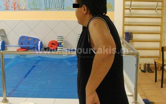 ΚΑΤΑΓΜΑ ΒΡΑΧΙΟΝΙΟΥ-ΚΑΤΑΓΜΑ ΥΠΟΚΕΦΑΛΙΚΟ-ΠΑΙΔΙΚΟ - Φυσικοθεραπευτήριο ...